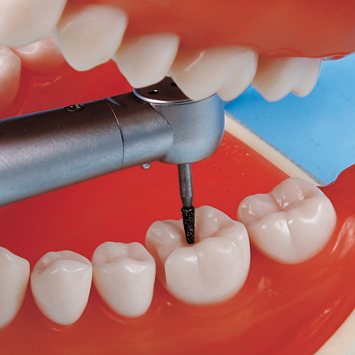 保存修復実習用顎模型 [D18D-500E(GUB)](D咬合器つき)｜株式会社ニッシン｜歯科模型・歯科材料のトップメーカーとして歯科学教育 ...